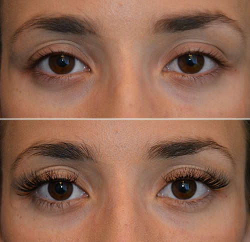 Extensions de Cils Lyon - Nadege Esthetique